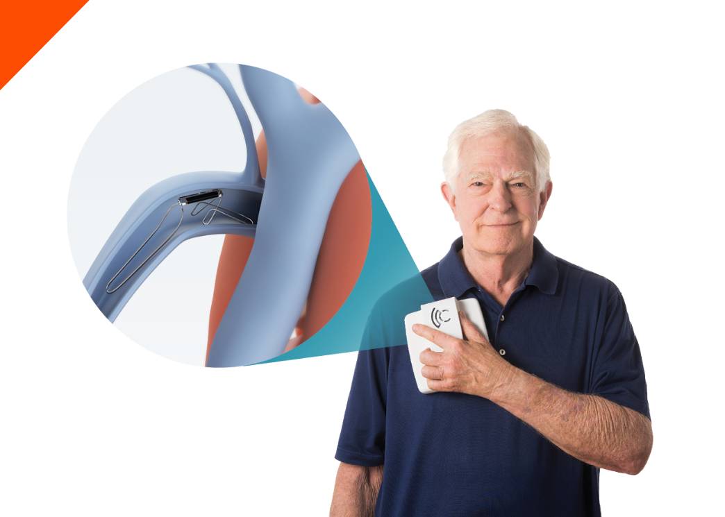 PROACTIVE-HF Trial | with the Cordella Heart Failure System